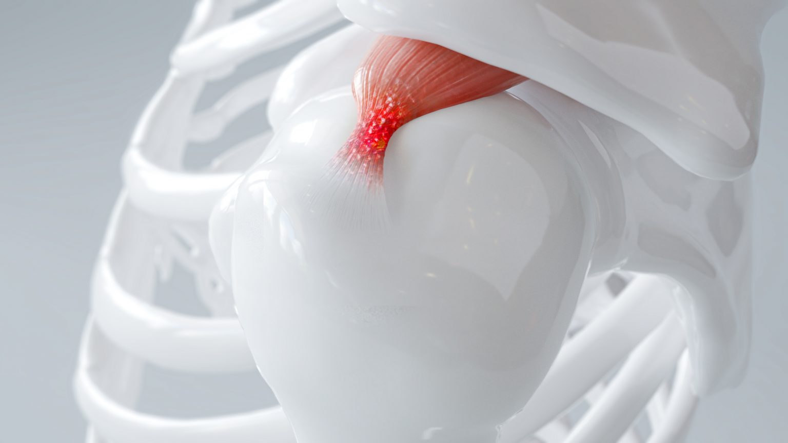 Rotator Cuff Tear Surgery: What to Expect | Surgery Consultants